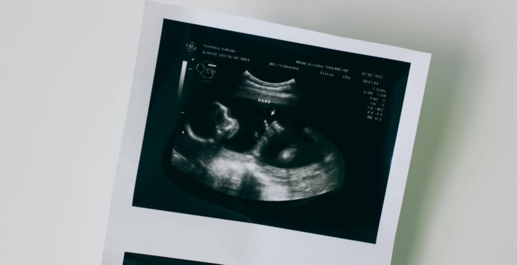 YouTube Celebrity Faces Backlash for Shocking Post about Abortion ...